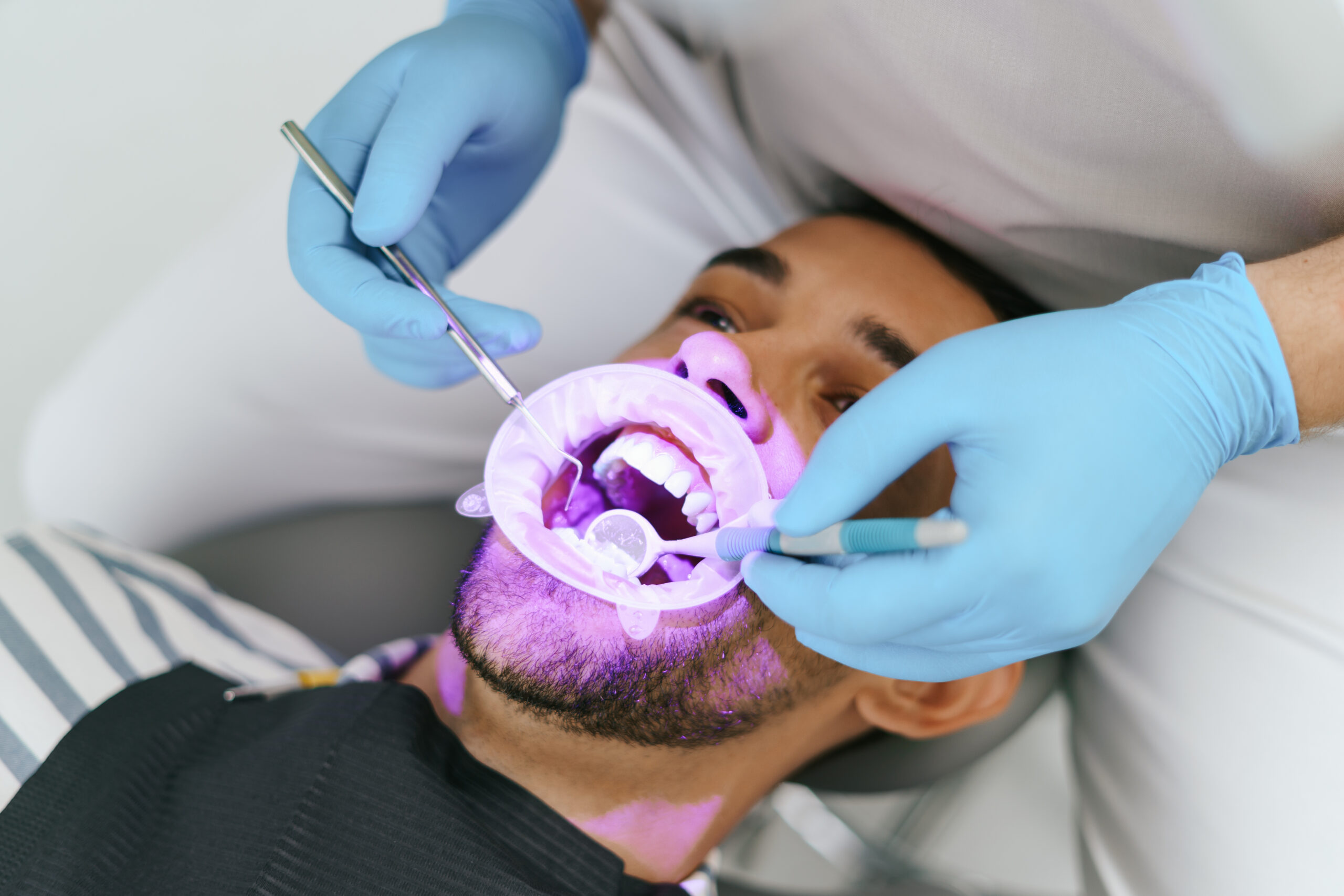 Three Signs You Could Benefit From Laser Teeth Whitening Treatments ...